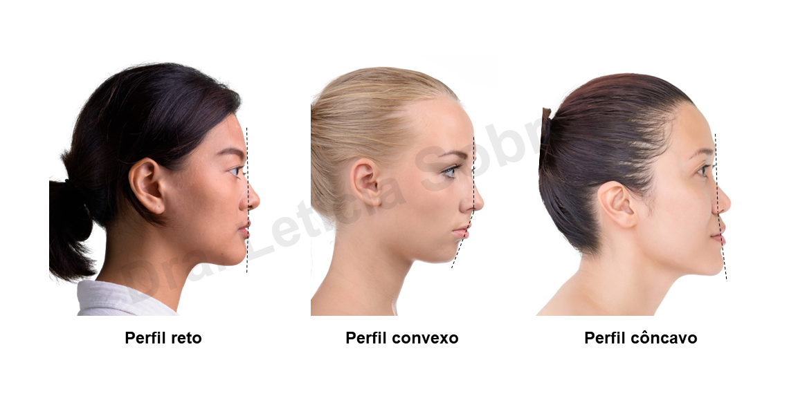 Ortodontia – Dra. Letícia Sobreiro